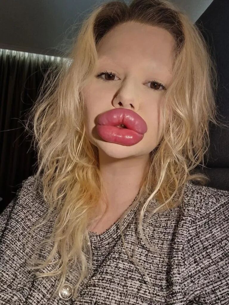 Deze vrouw heeft officieel de grootste lippen ter wereld